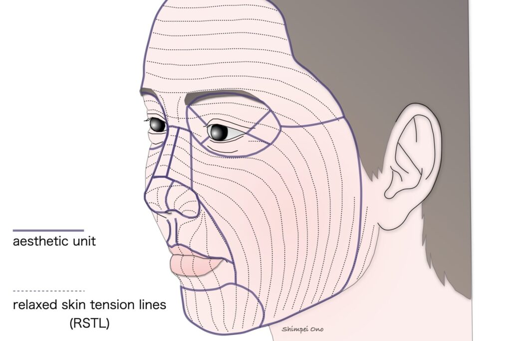 【Step by Step 手術手技】顔の石灰化上皮腫 - マイナー外科・救急