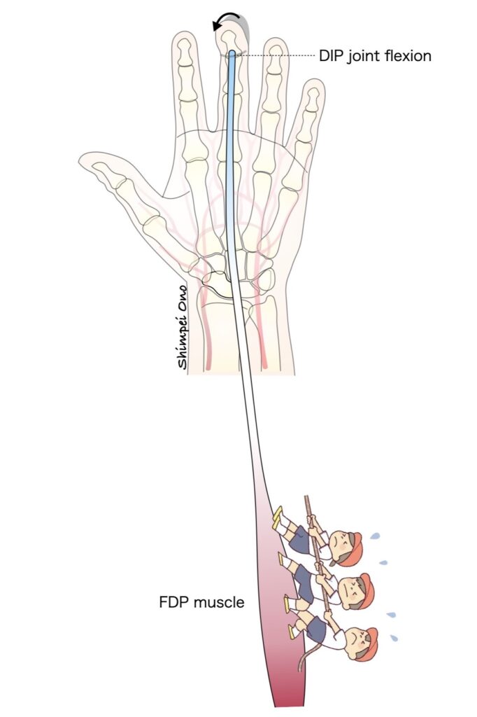 【診療Tips】FDS test、FDP test - マイナー外科・救急