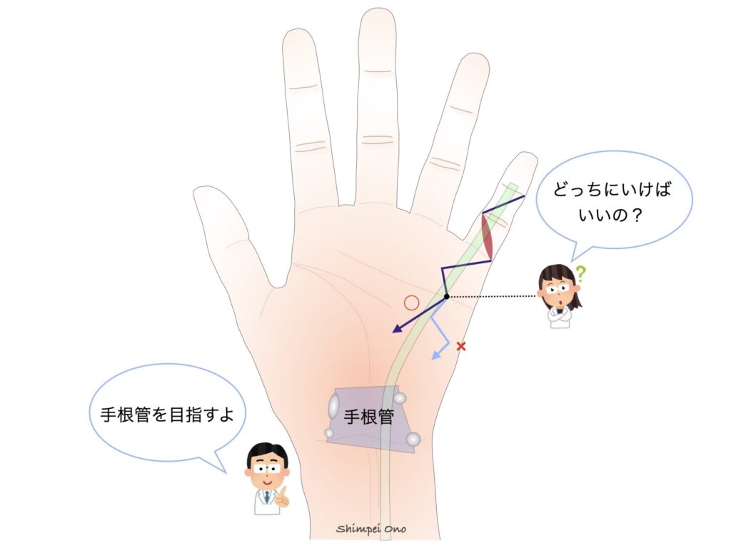 【診療Tips】手指手術の切開法：Bruner's incision、Midlateral incision - マイナー外科・救急