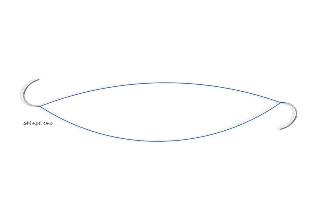 【診療Tips】Modified Kessler suture technique - マイナー外科・救急