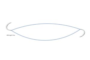 【診療Tips】Modified Kessler suture technique - マイナー外科・救急