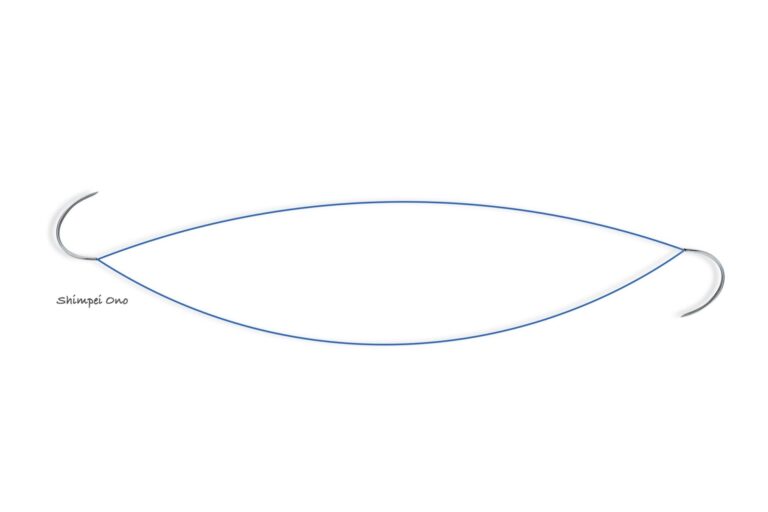【診療Tips】Modified Kessler suture technique - マイナー外科・救急