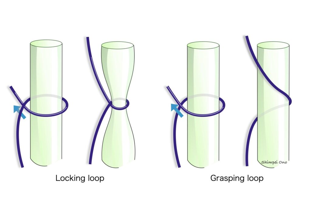 【診療Tips】腱縫合におけるLockingとGraspingの違い - マイナー外科・救急