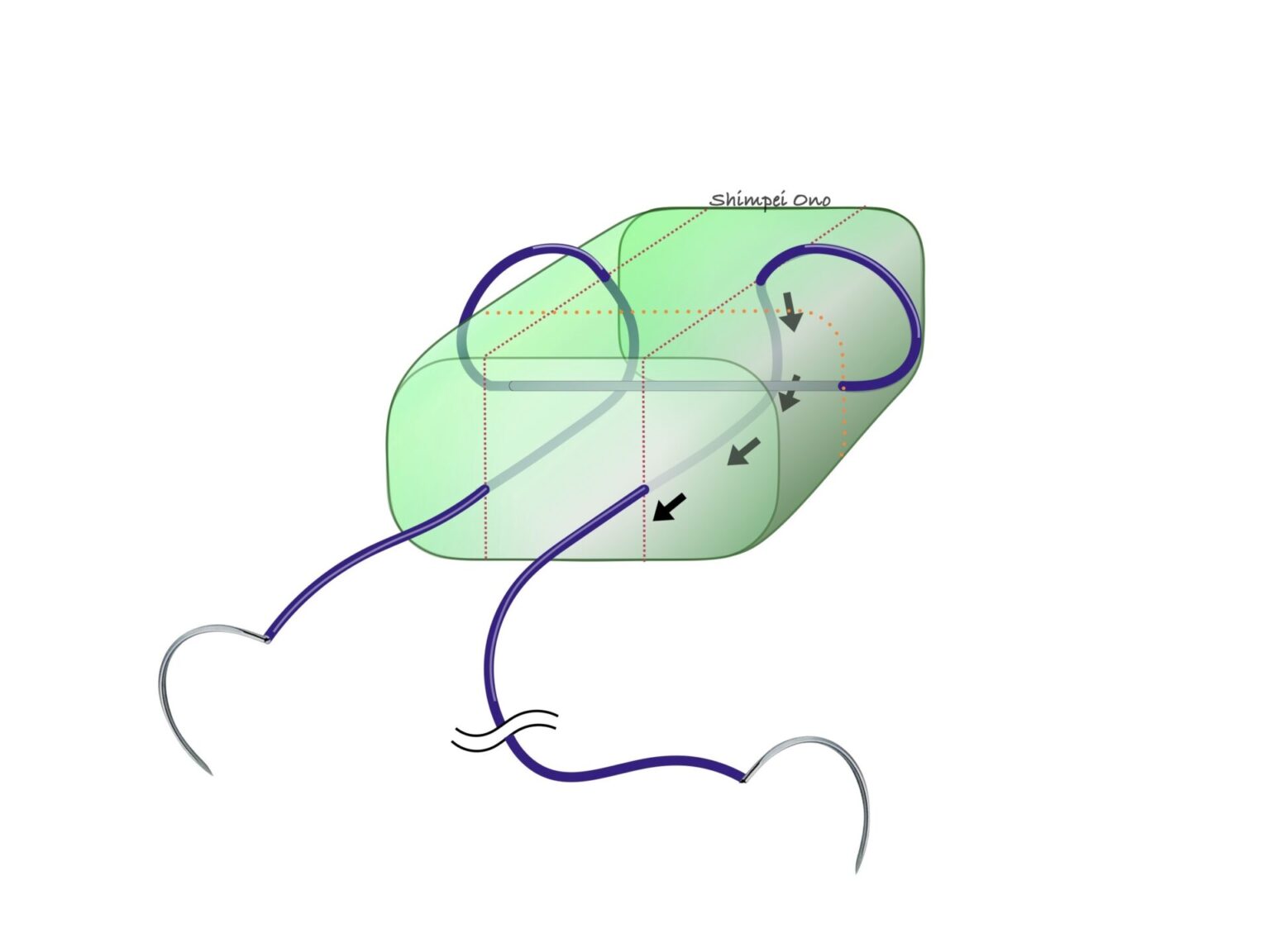 【診療Tips】Modified Kessler suture technique - マイナー外科・救急