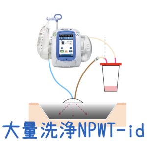 NPWT-id Archives - マイナー外科・救急