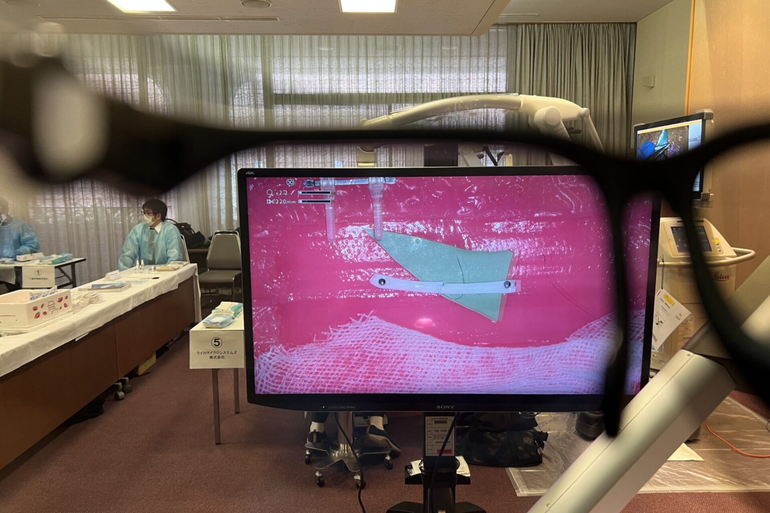 【診療Tips】最新4K3D外科用顕微鏡「オーブアイ（ORBEYE）」の特長と臨床応用：マイクロサージャリーへの革新 - マイナー外科・救急