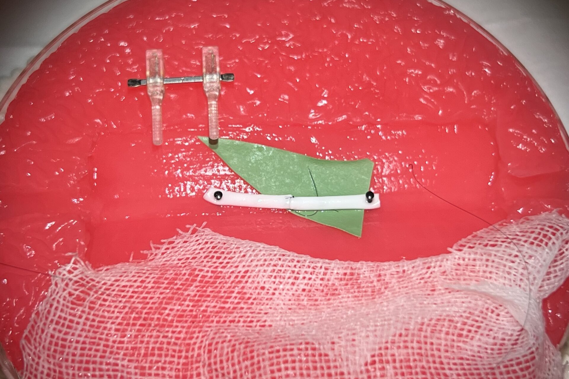 【診療Tips】最新4K3D外科用顕微鏡「オーブアイ（ORBEYE）」の特長と臨床応用：マイクロサージャリーへの革新 - マイナー外科・救急